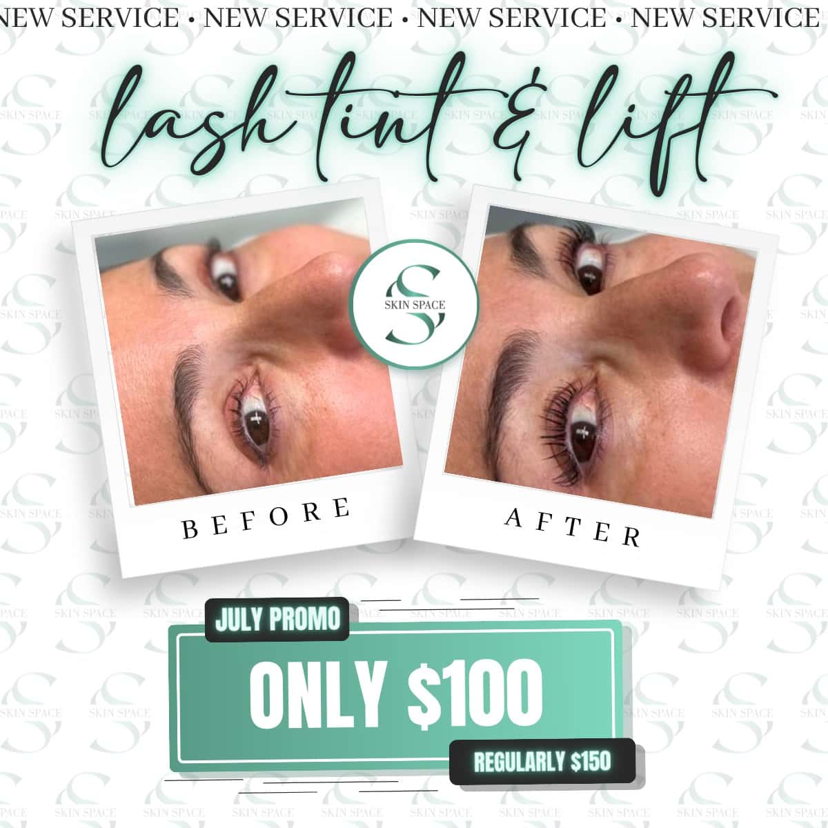 Skin Space Massapequa Promotions | Medspa Deals & Promotions